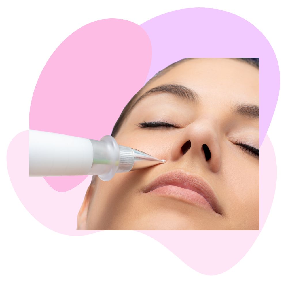 Laser Endolifting Sesto San Giovanni Chirurgo specializzato in ...